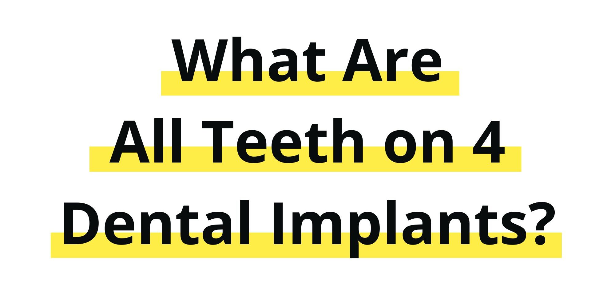 What Are All Teeth on 4 Dental Implants? - All at Once® Implant Bridge